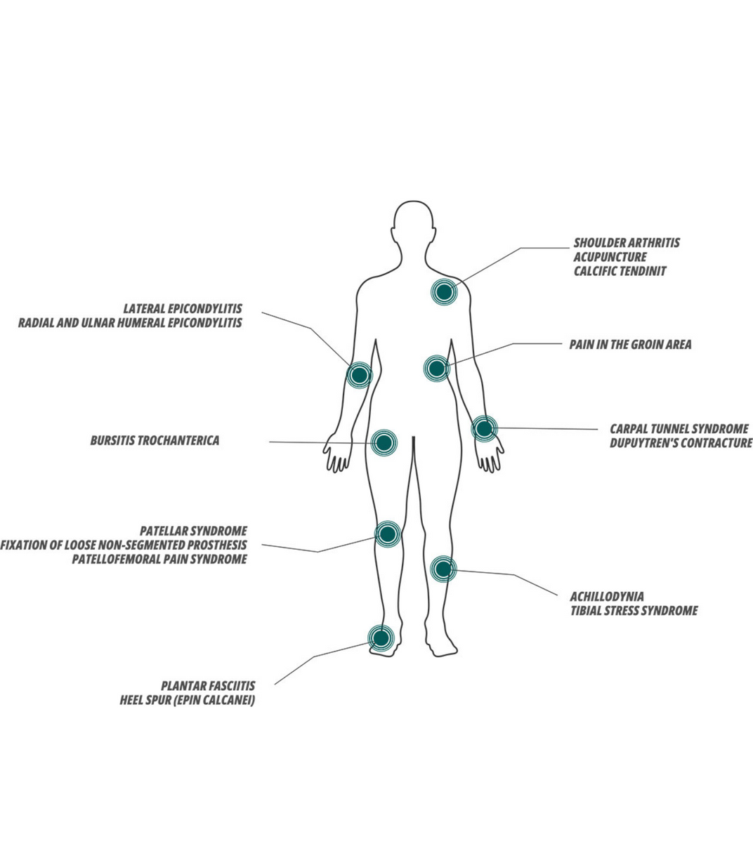 Shockwave Pro | Advanced Focused ESWT Device | FDA Registered Manufacturer